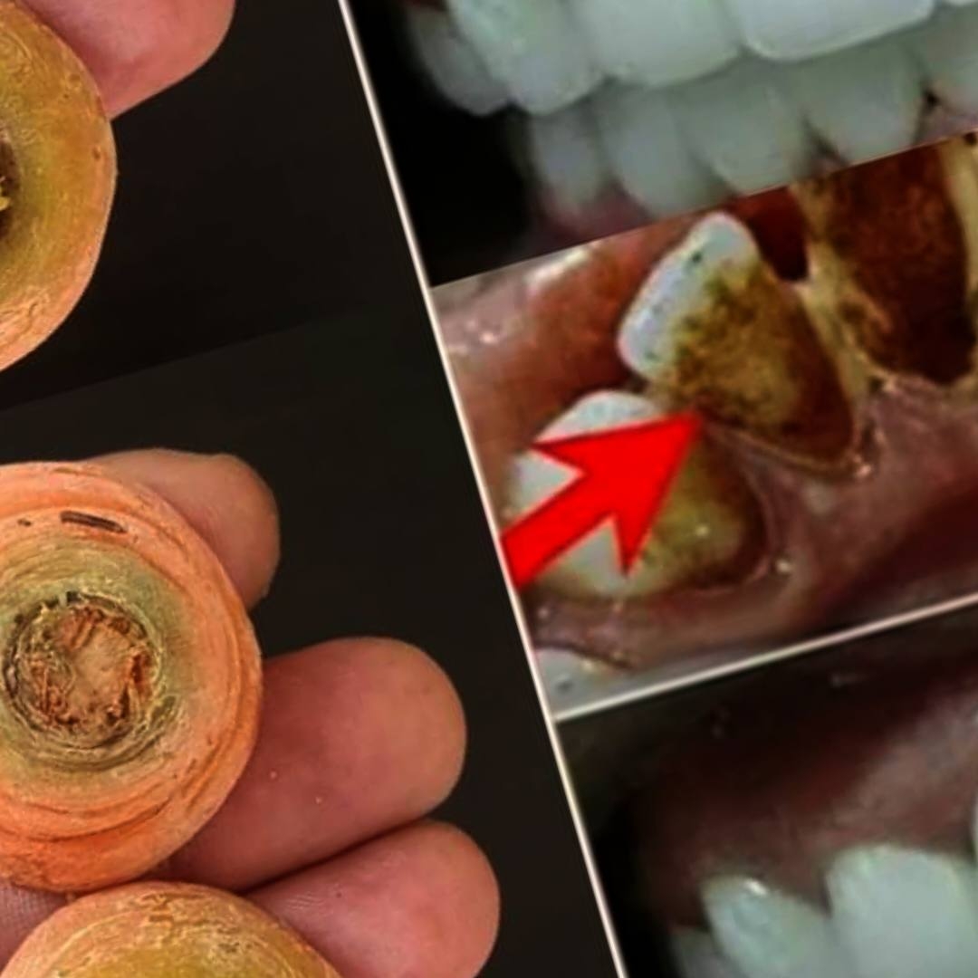 Improve Your Smile Naturally with Carrot Ends: An Easy Home Solution ...